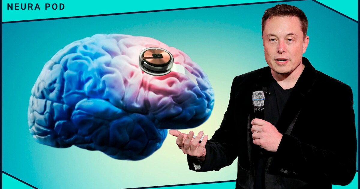 Elon Musk meldt eerste succesvolle implantatie van hersenchip in mens ...