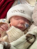Baby Vinnie uit Wales wordt door zeldzame aandoening geboren met oor op ...