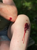 Valpartij tijdens ‘Tour de Truus’ in Beuningen: ‘Ik wilde even kijken ...