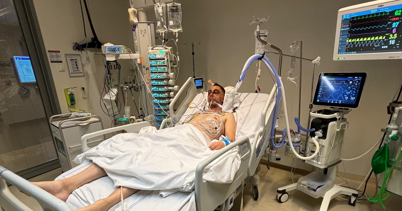 Elk bot in zijn gezicht was gebroken na aanval met tegel, nu doet ...