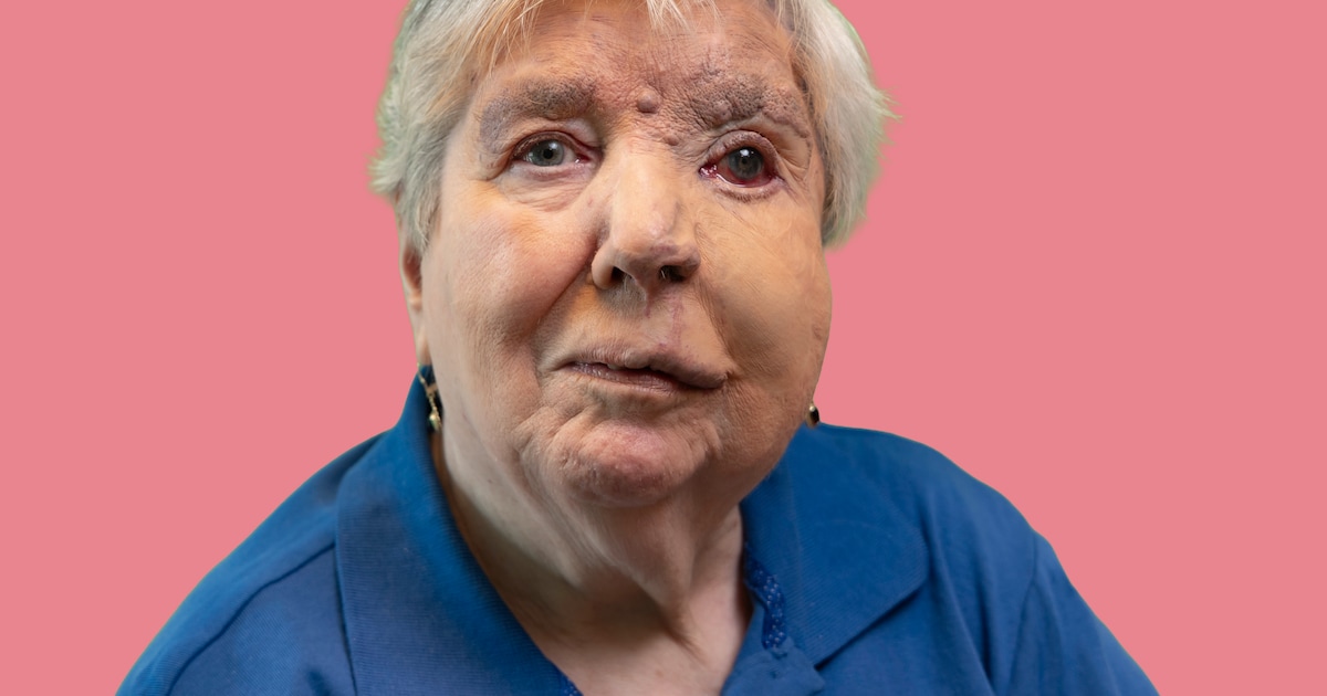 Ze zou geen 10 jaar worden, zei de arts over Sita. Inmiddels is ze 77 ...