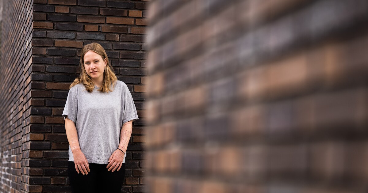 Na mislukte elektroshocktherapie probeert Joyce het nog één keer: met ...