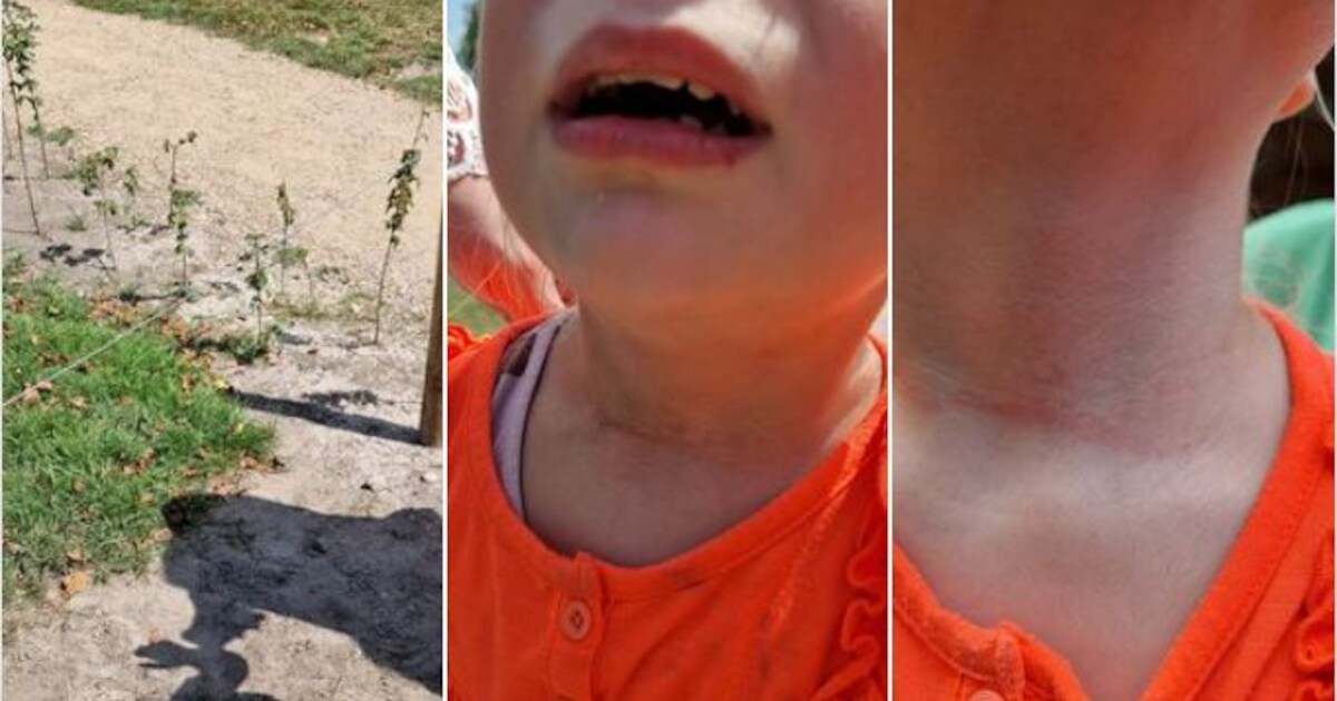 Staaldraad in speeltuin zorgt voor blauwe nek meisje (4), gemeente ...