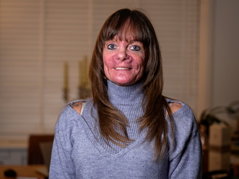 Carola’s gezicht verandert drastisch na zwangerschap: ‘Ze scholden me ...