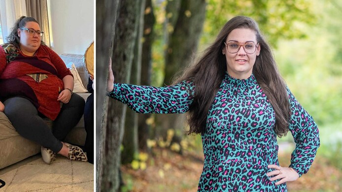 Shanon (die 85 kilo afviel) is afgewezen om overtollig vel te laten ...