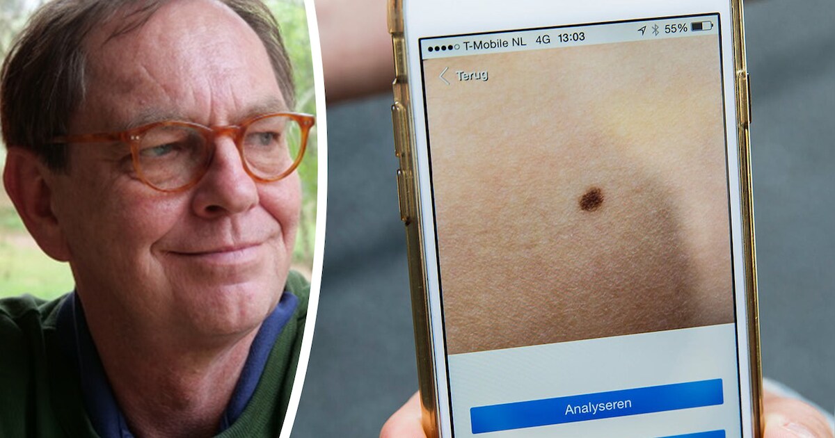 ‘Huidkanker opsporen via app gaat nog te vaak fout’ | Lochem ...