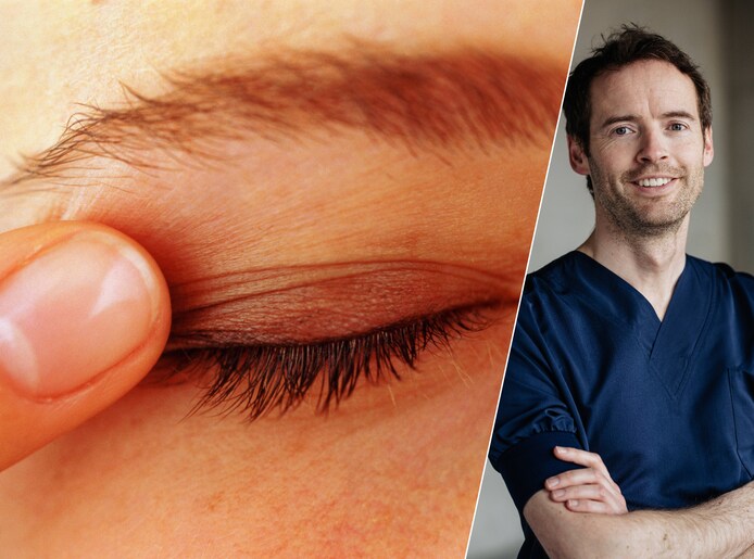 Af en toe last van een trillend ooglid? Oogchirurg over de oorzaak en ...